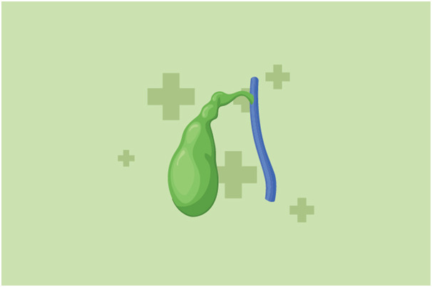 KANKER CHOLANGIOCARCINOMA, KANKER GANAS DI SALURAN EMPEDU – LEMBAGA ...